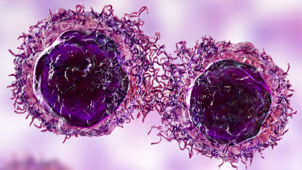Deteccion di cancer “Santo Grial” ta pronostica tumor un aña prome cu ...